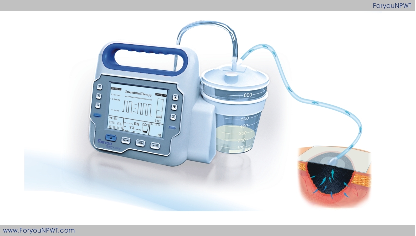 NPWT图册_360百科