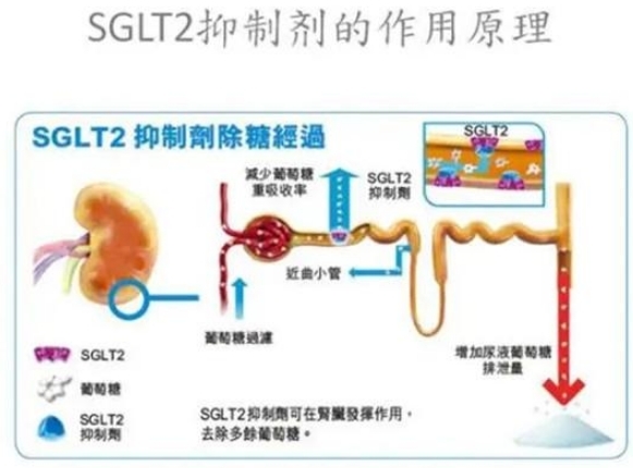 SGLT-2抑制剂图册_360百科