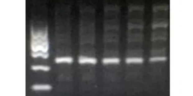 dna电泳条带怎么分析_360新知