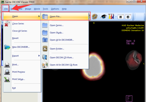 dcm格式图像怎么打开并保存为Jpg格式_360新知