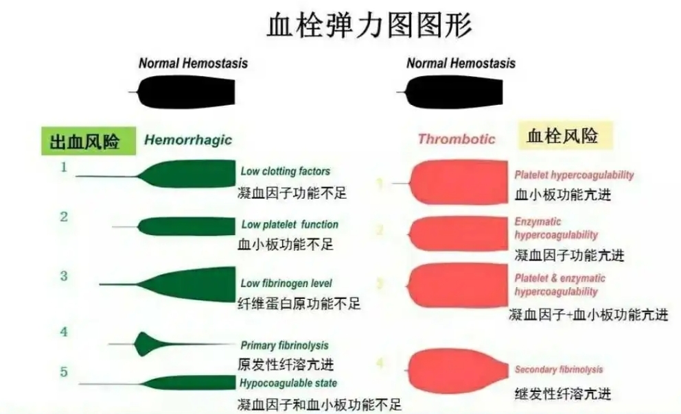 血栓弹力图图册_360百科