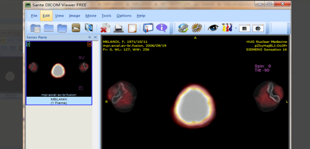 dcm文件怎么打开_360新知