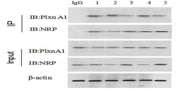 coip原理及实验步骤_360新知