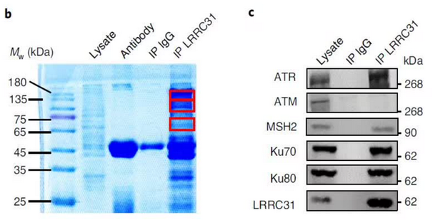 dna电泳条带怎么分析_360新知