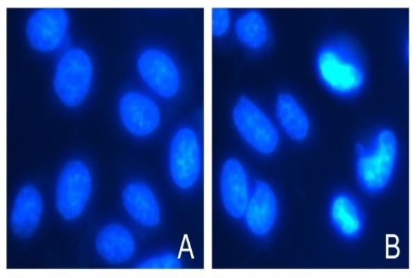 DAPI和hoechst染色的区别 – 960化工网问答