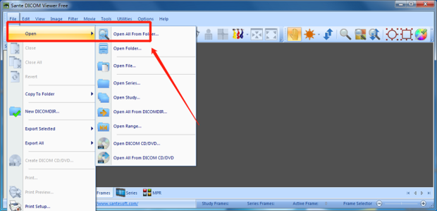 dcm文件怎么打开_360新知